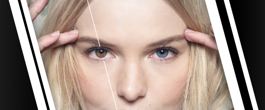 Heterocromia - entenda o que é e quais os tipos